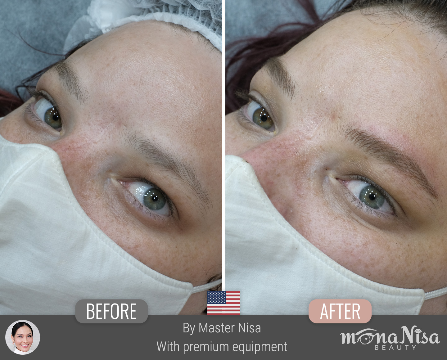 View only photos of realistic eyebrow tattoo (Nano needle with machine ...